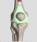 What is Patellofemoral Pain Syndrome (PFPS)? - The Physios