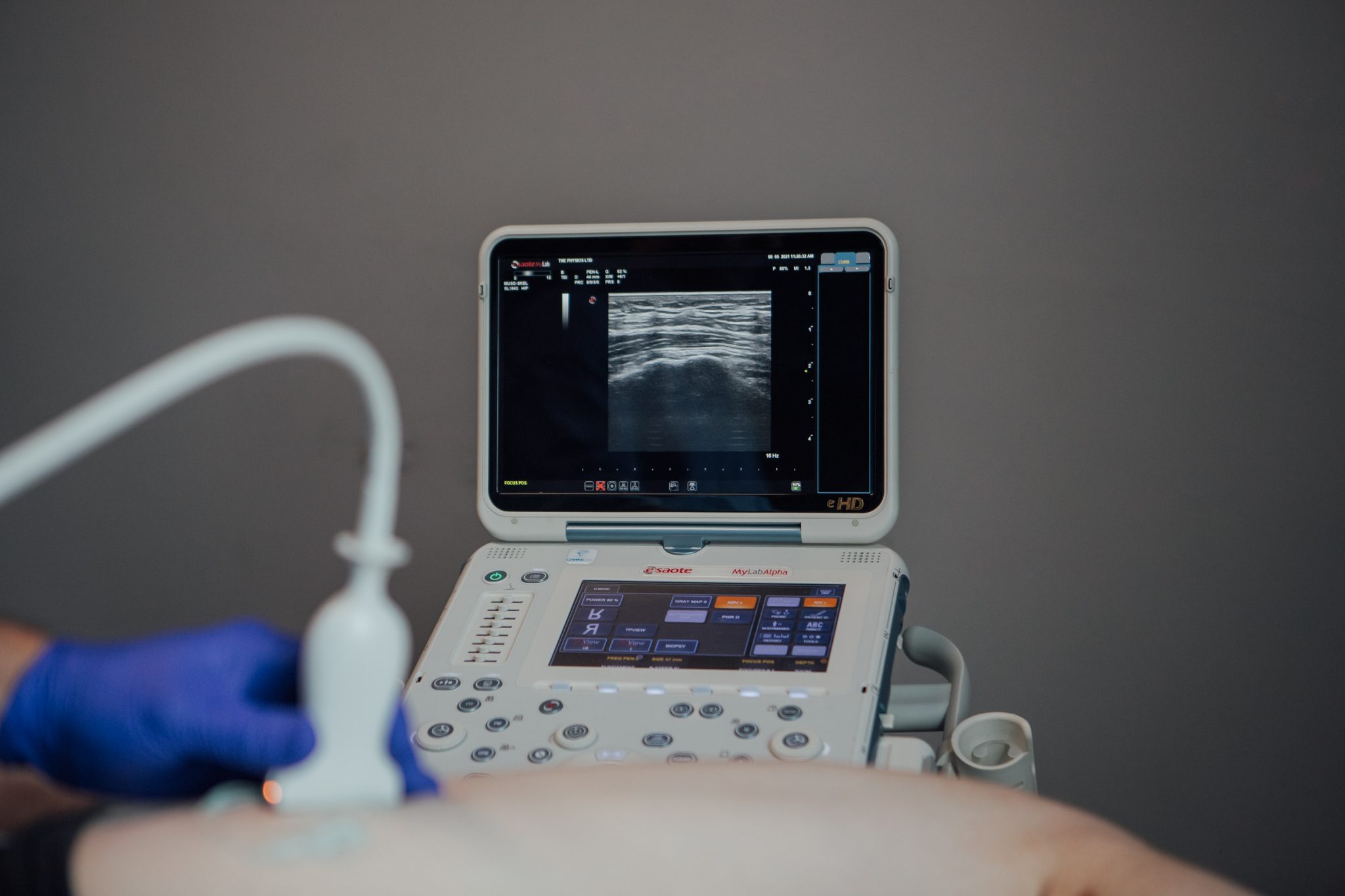 What Is Hamstring Tendinopathy? | The Physios